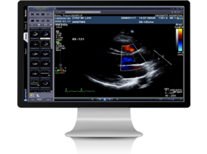 Cardio PACS | INFINITT - infinitteurope