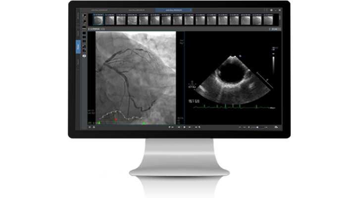 Cardio PACS | INFINITT - infinitteurope