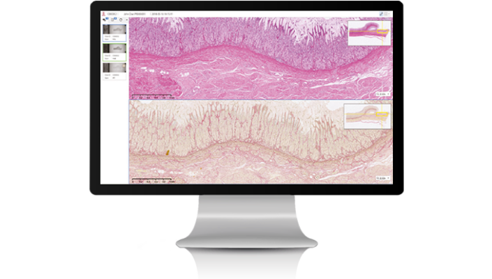 Digital pathology solution | INFINITT - infinitteurope