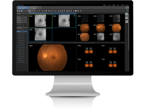 Ophthalmology | INFINITT - infinitteurope