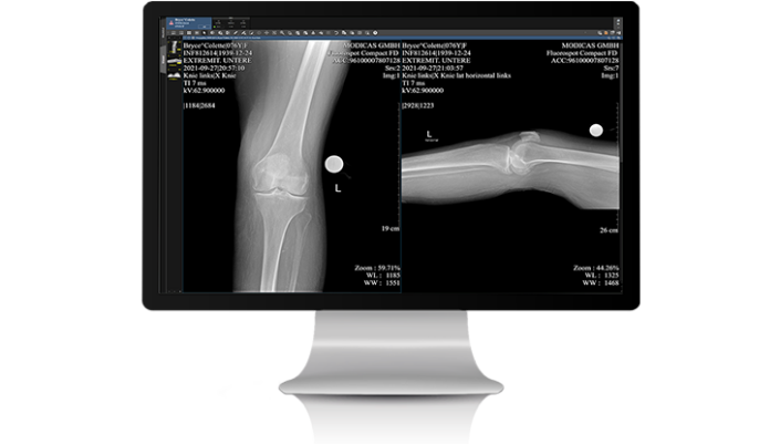 Universal Viewer | INFINITT - infinitteurope